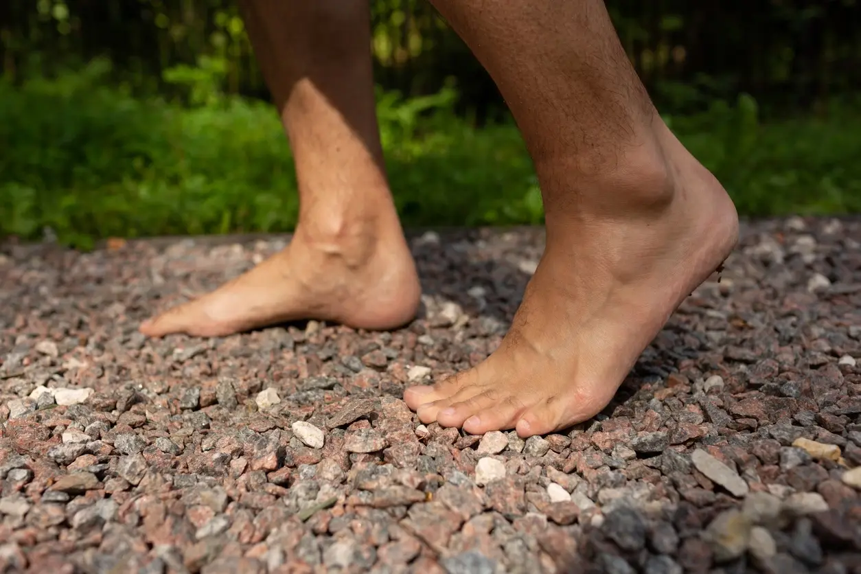 What do I do about my overlapping and bent toes?