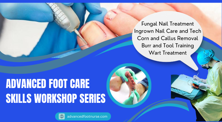 Level Up Your Foot Care Business: New Skills Workshops for Nurses ...